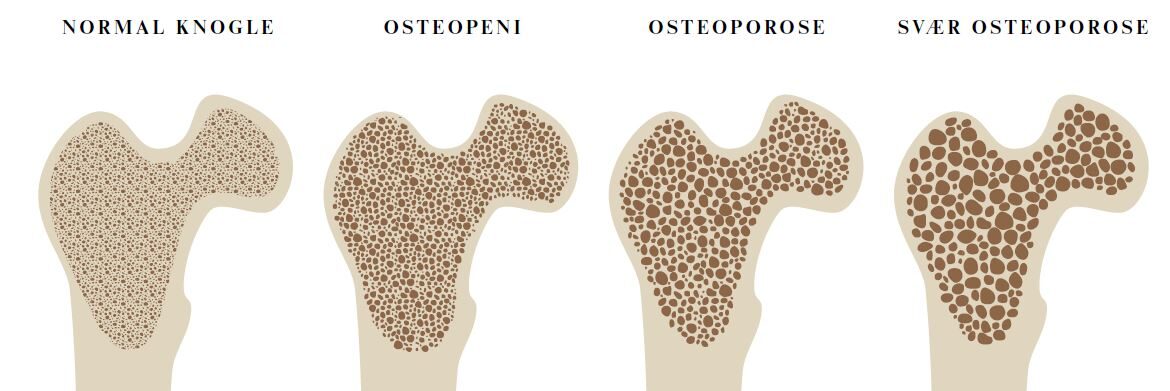 Medicinske præparater - Osteoporose.dk